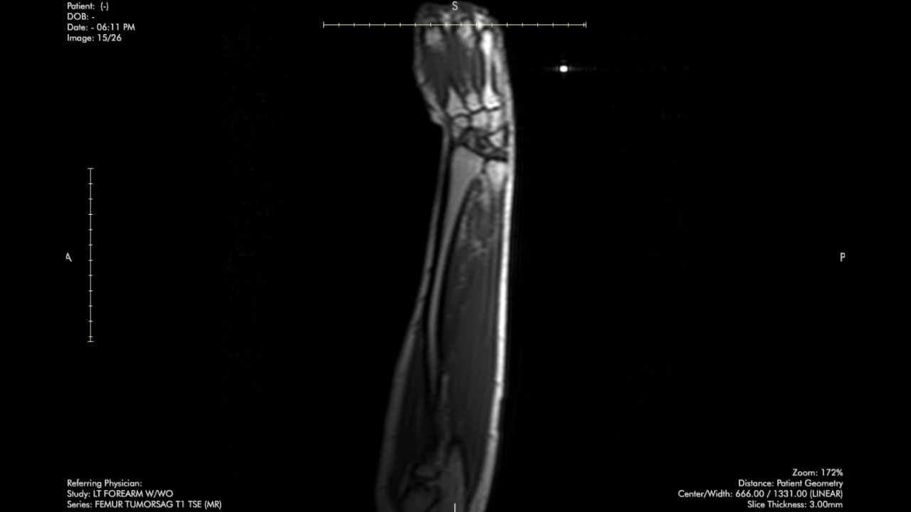Forearm Mri Cases Radiology Course Mri Online Is Now Medality