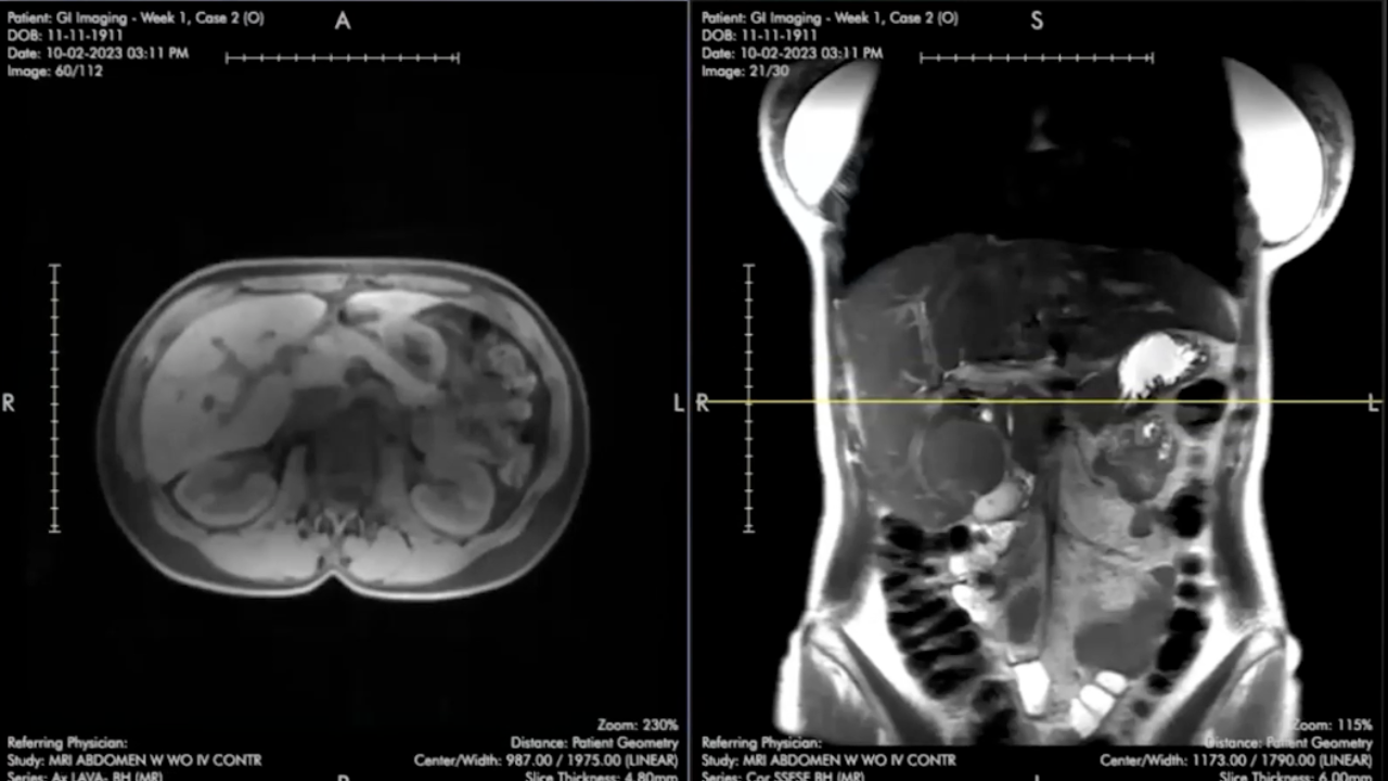 Gi Fellowship Practice Cases Radiology Course Mri Online Is Now Medality