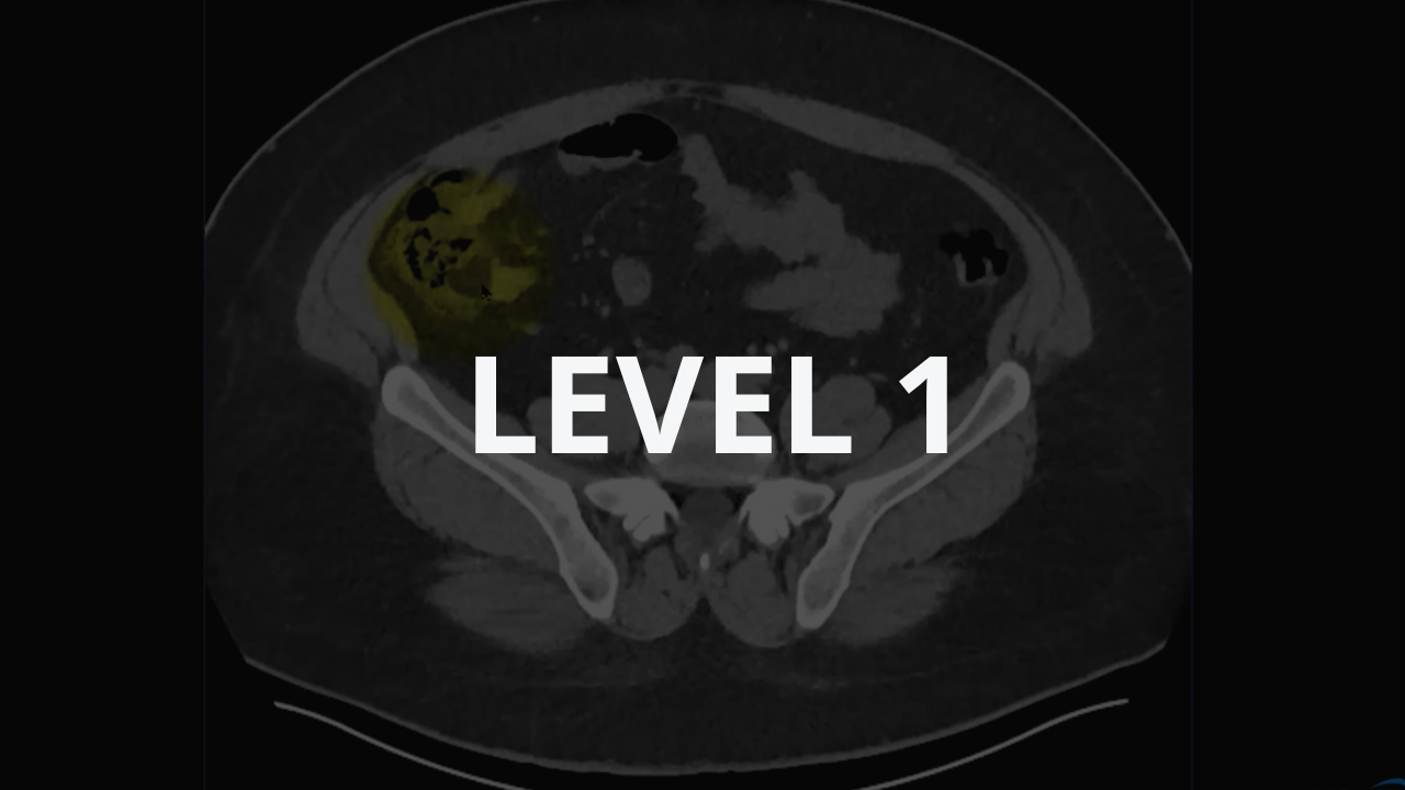 Body Imaging Fundamentals Level 1 Mri Online Is Now Medality